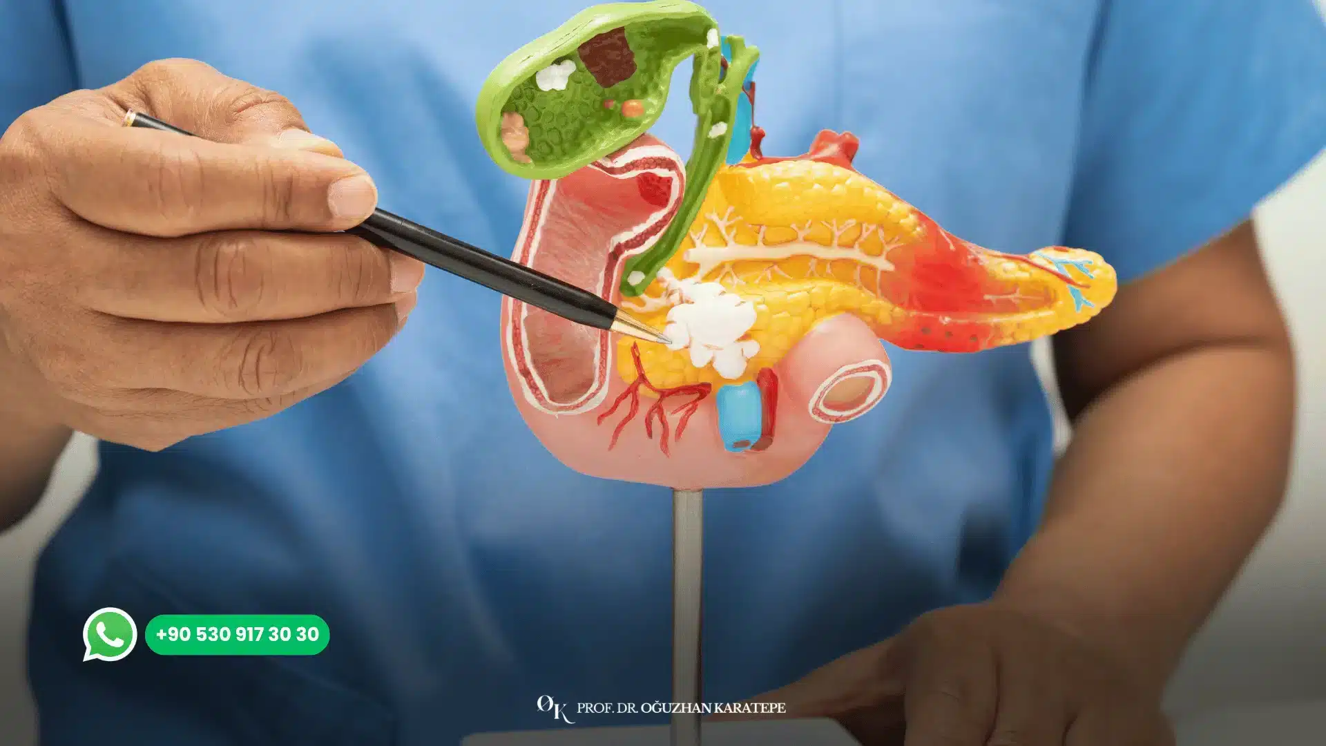 Gallbladder Cancer: Symptoms, Treatment & Prognosis