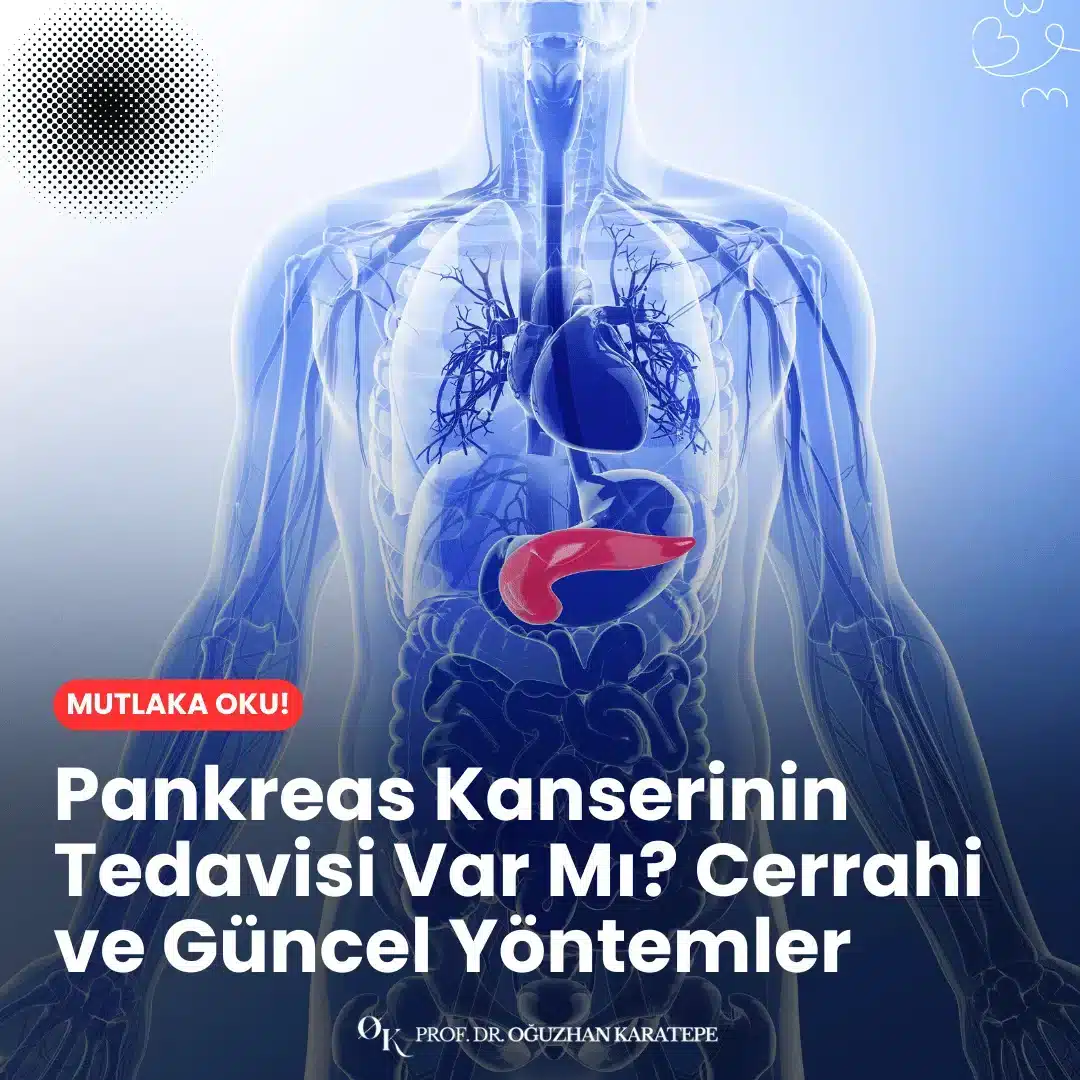 Pankreas Kanserinin Tedavisi Var Mı? Cerrahi Ve Güncel Yöntemler